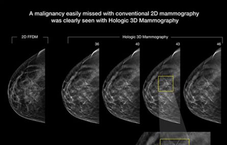 Mammography | Orange Coast Women's Medical Group